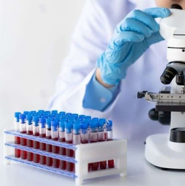 How Third-Party Laboratory Tests Work: The Janoshik Analytical Case ...